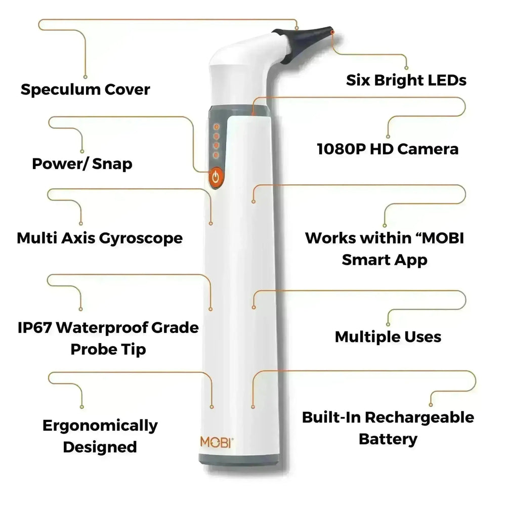 Ear, Nose & Throat Smart Wi-Fi Otoscope With HD Camera - MOBI USA