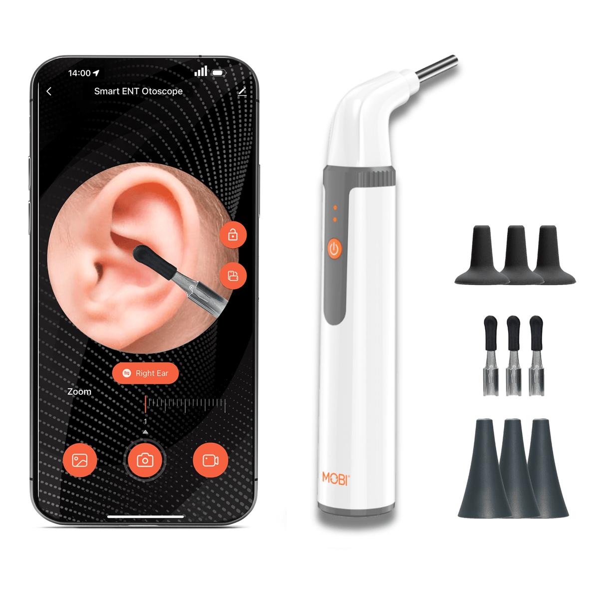 MOBI Ear, Nose & Throat Smart Otoscope Jr. HD Camera-1080P HD Lens,