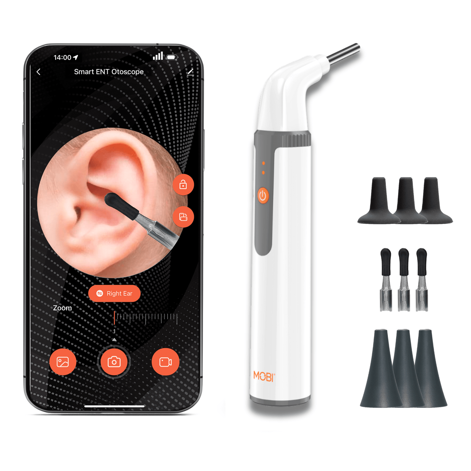 MOBI Ear, Nose & Throat Smart Otoscope Jr. HD Camera-1080P HD Lens,